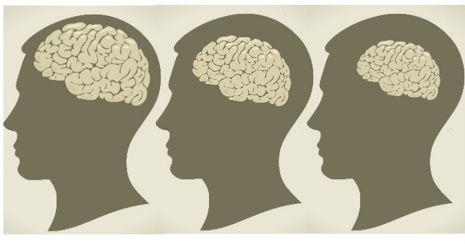 Trapped by the Box: Why our brains are shrinking