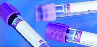 การตรวจความสมบูรณ์ของเม็ดเลือด (CBC : Complete Blood Count): การตรวจ ...