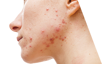 VIDA SANA Y NATURAL : RECETAS Y CUIDADOS PARA EL CUTIS MIXTO