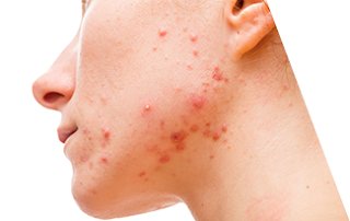 VIDA SANA Y NATURAL : RECETAS Y CUIDADOS PARA EL CUTIS MIXTO