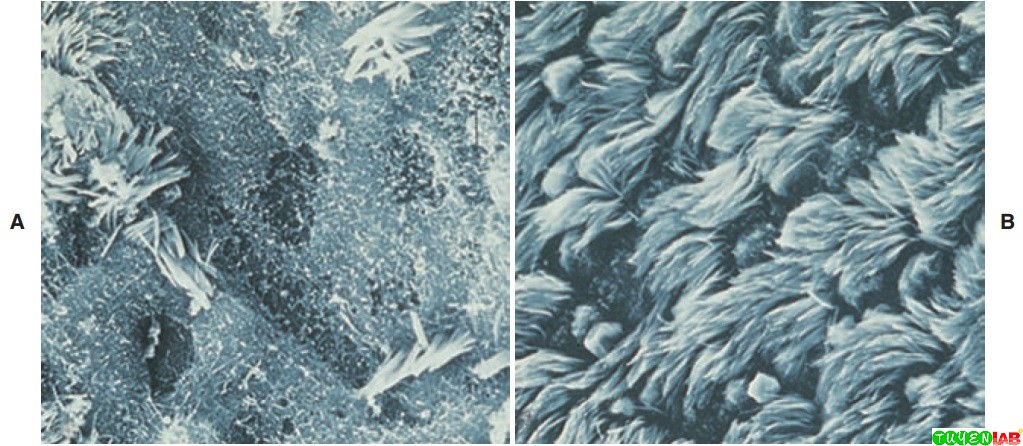 [Microbiology] Atlas of Mycoplasma and Ureaplasma | Free Medical Atlas