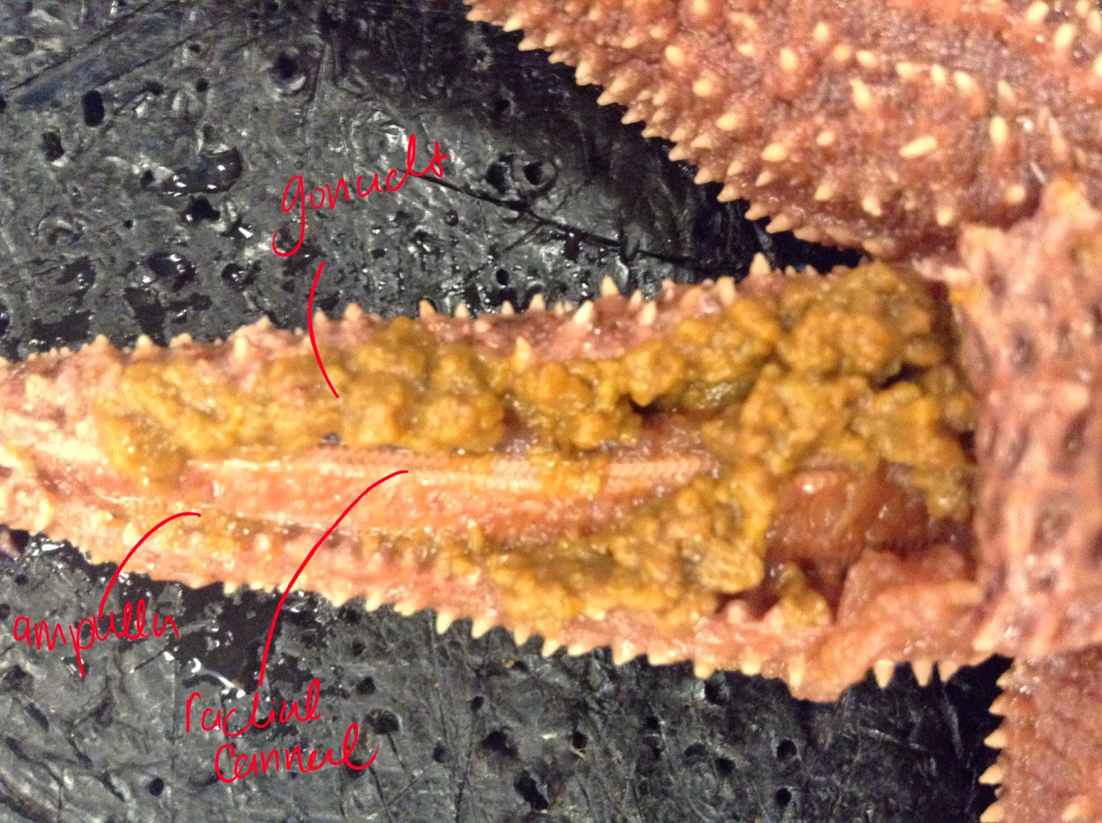 Set The House Spider Free: Star Fish Dissection