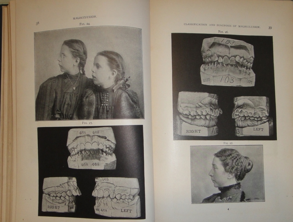 ORTODONTIA CONTEMPORÂNEA: Livro clássico com 112 anos, do Professor ...