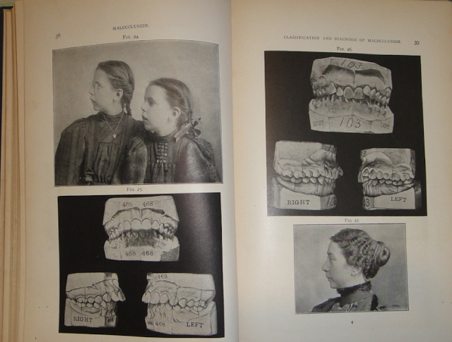 ORTODONTIA CONTEMPORÂNEA: Livro clássico com 112 anos, do Professor ...