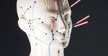 The Tales of a Stroke Patient and More: Acupuncture--It Isn't For The ...