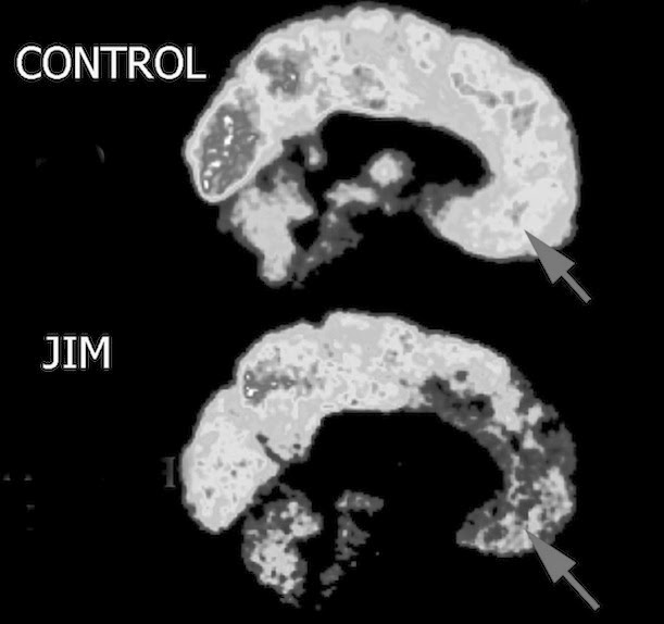The Neurocritic: November 2013