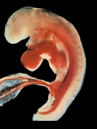 Ayat-Ayat Tentang Embrio Manusia | ILMU DARI AL-QURAN