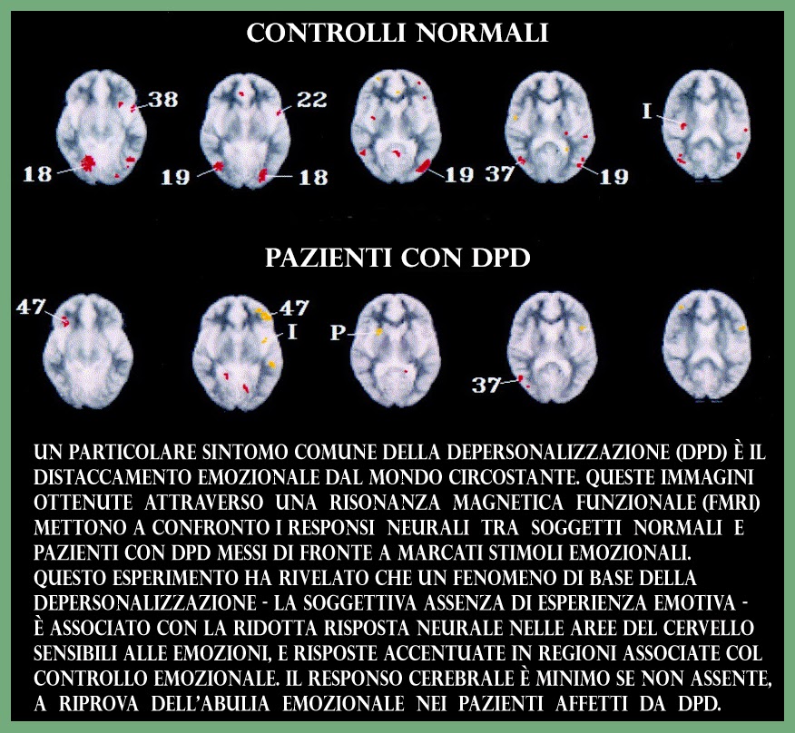 Il Credino: La Sacra Sindrome: L'Anatomia Del Credino