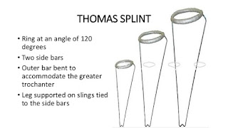 Splints // Types