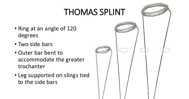 Splints // Types