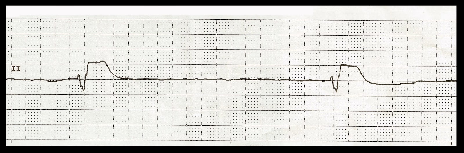 Practice EKG Strips 396