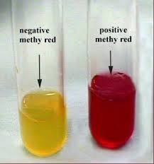 IMVIC TEST (Indole Test, Methyl Red Test, Voges Proskauer Test and ...