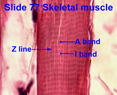 HISTOLOGY PICTURES: Muscle
