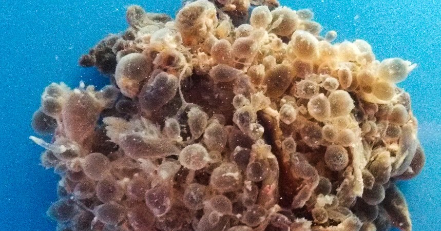 Patología CC: Embarazo molar (Mola hidatiforme completa)