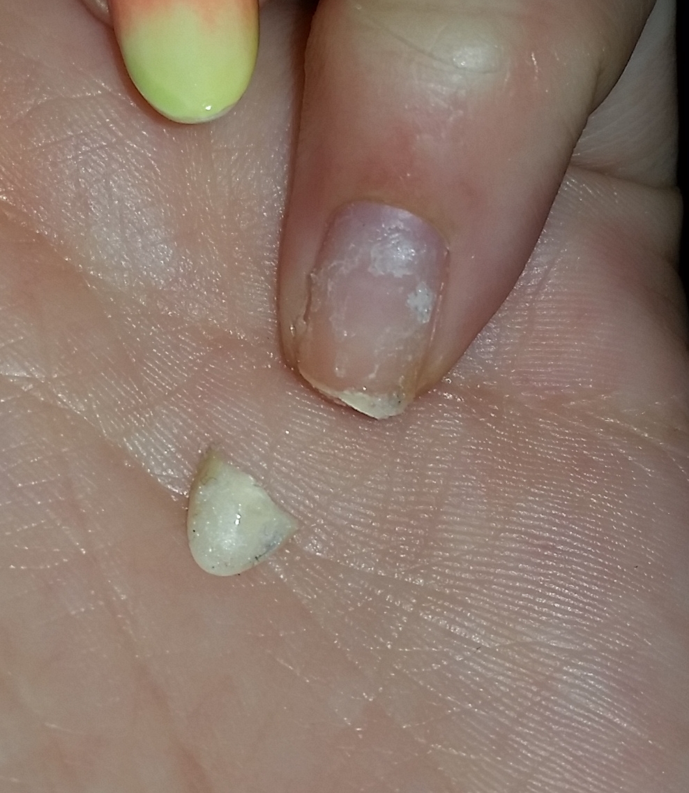 Kate's Nailing It: The Sad Tale of the Broken Nail