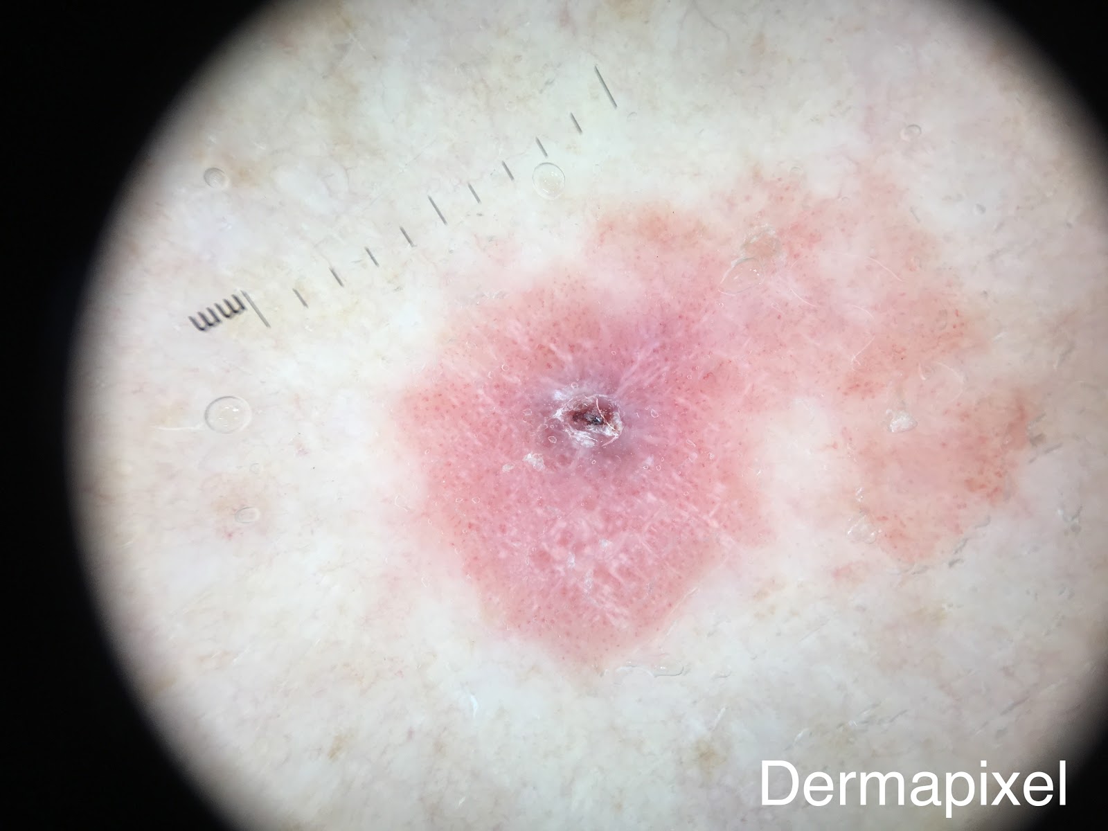 Dermapixel: mayo 2018