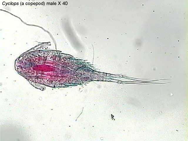 Medical Laboratory Technology - SOP: Dracunculus Medinensis