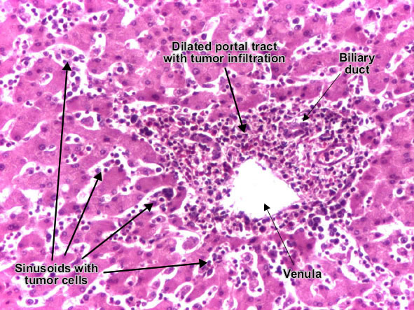 موقع الدكتور أحمد كلحى: باثولوجى Pathology Slides : Hematopathology
