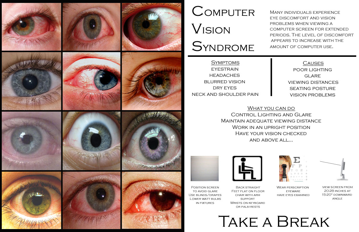 1. Penglihatan Visual Lesu