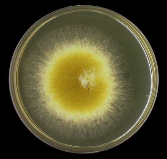 Fun With Microbiology (What's Buggin' You?): Arthrographis species