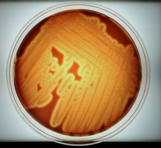 BLOOD AGAR - Microbiology Laboratory Turkey