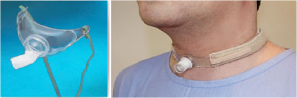 Traqueostomia e os cuidados de enfermagem - Enfermagem