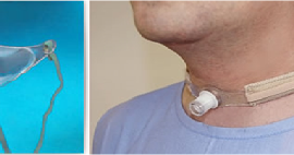 Traqueostomia e os cuidados de enfermagem | Enfermagem