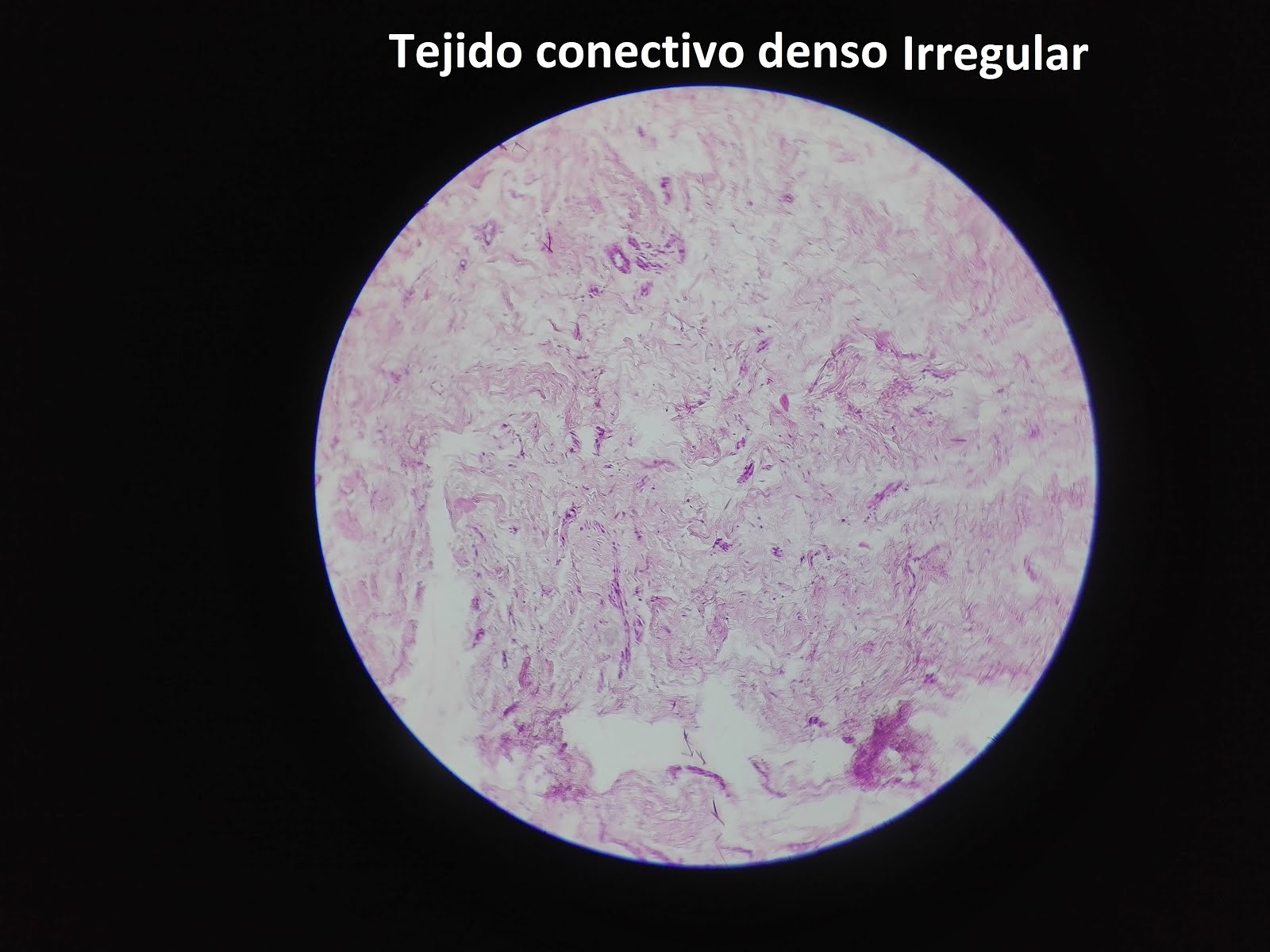 Neo médico : Tejido conectivo - Imagenes histologicas (Microscopicas)