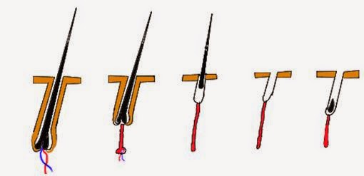 Todo sobre la depilación láser: Las 3 fases del pelo: Cuando depilar.