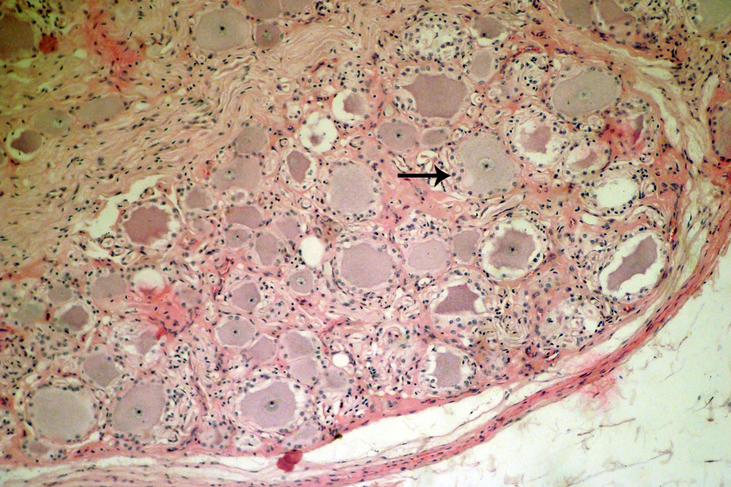 Histologia UFJF: Lâmina 76 - Tecido Nervoso - Gânglio