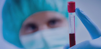 Mi viejo maletin: 4K score Test