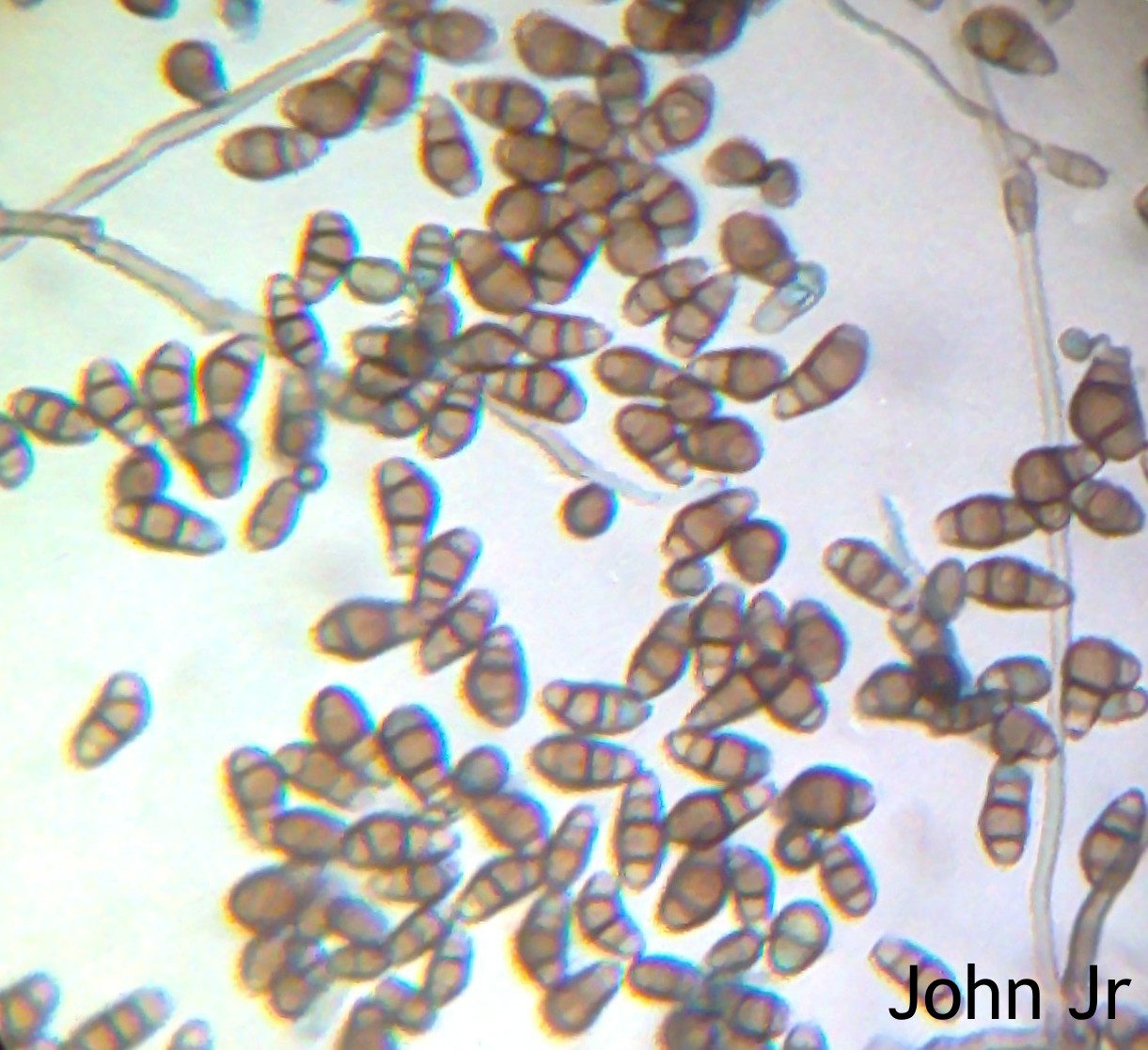Um Convite à Biomedicina: Curvularia e sua relação com a agricultura