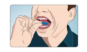 Our Parkinson's Place: Sunovion Announces FDA Acceptance of New Drug ...