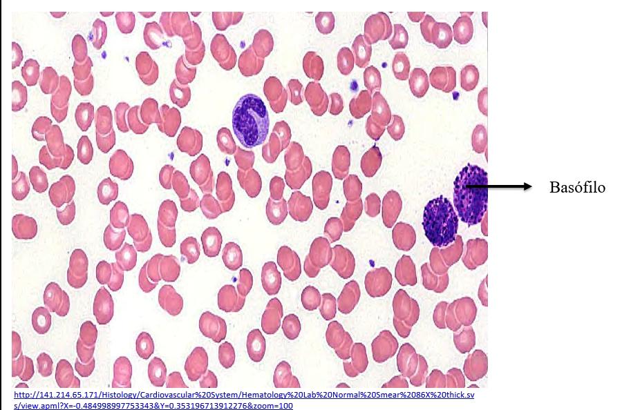 Diferencias histológicas entre las células precursoras de la sangre ...