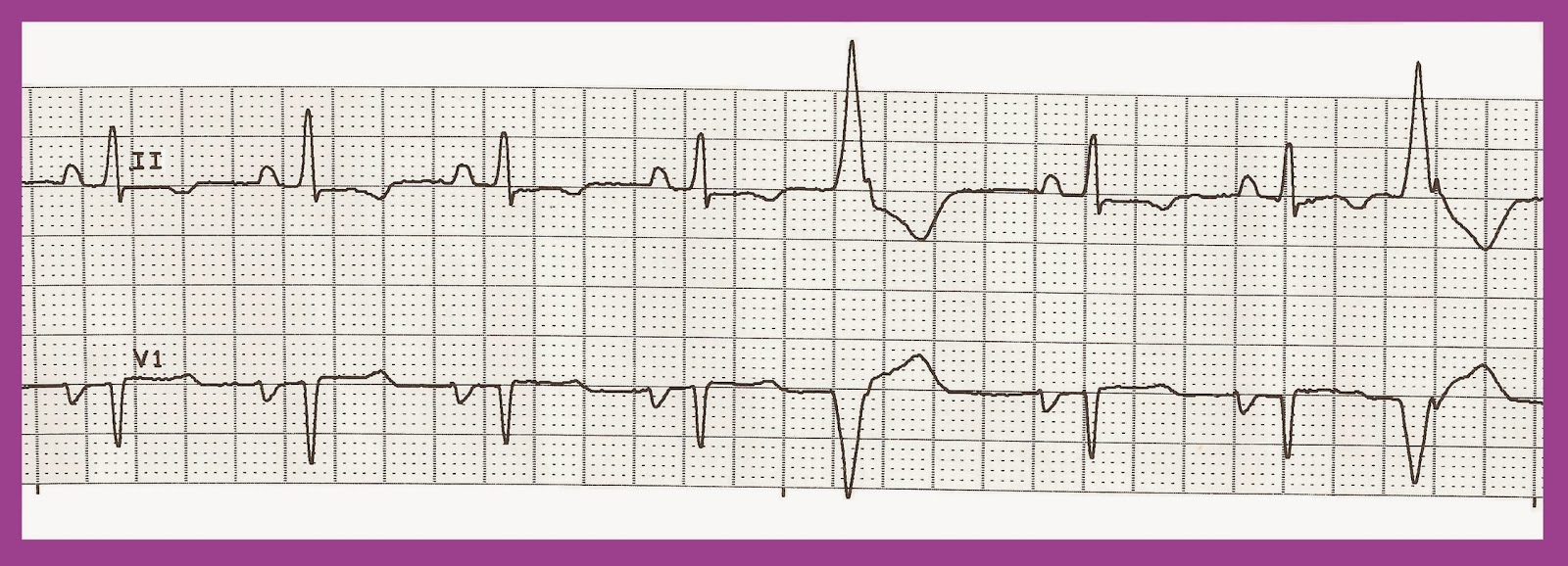 Float Nurse: February 2014