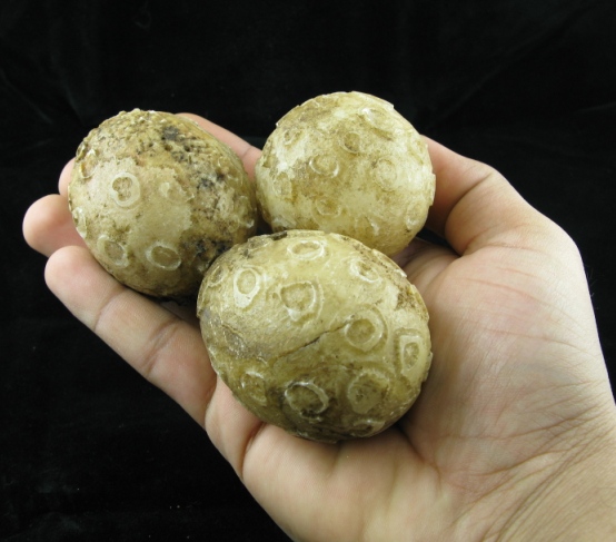 Deformutilation: Bezoar Stones and Mustika Pearls