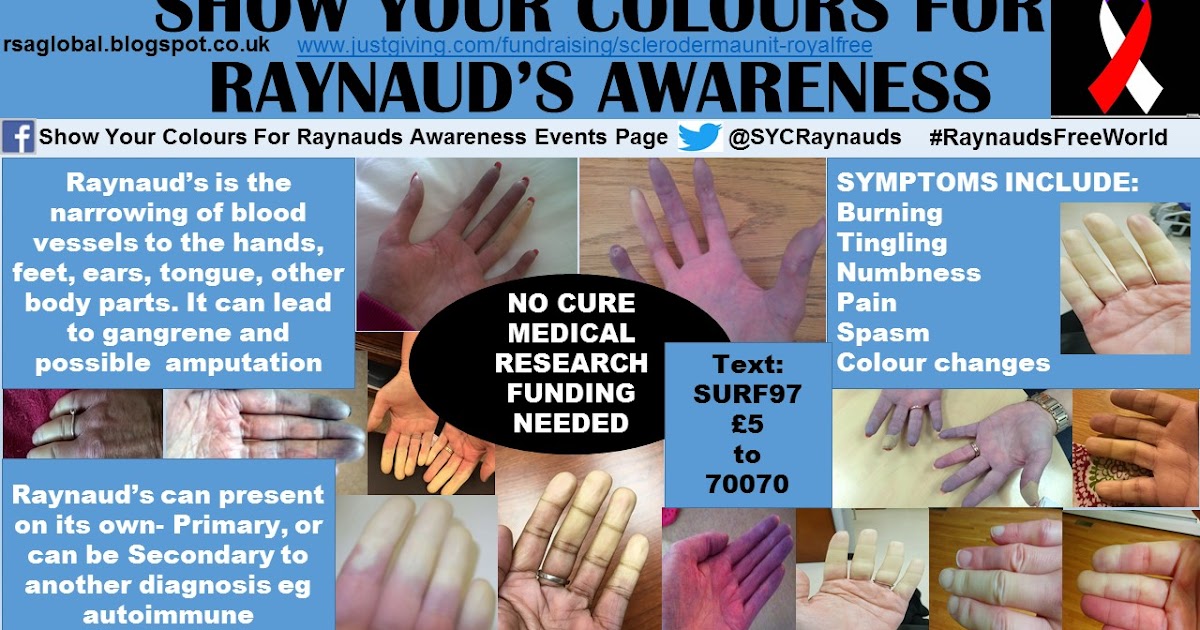 Raynauds Scleroderma Global Patients: ShowYourColoursForRaynauds ...