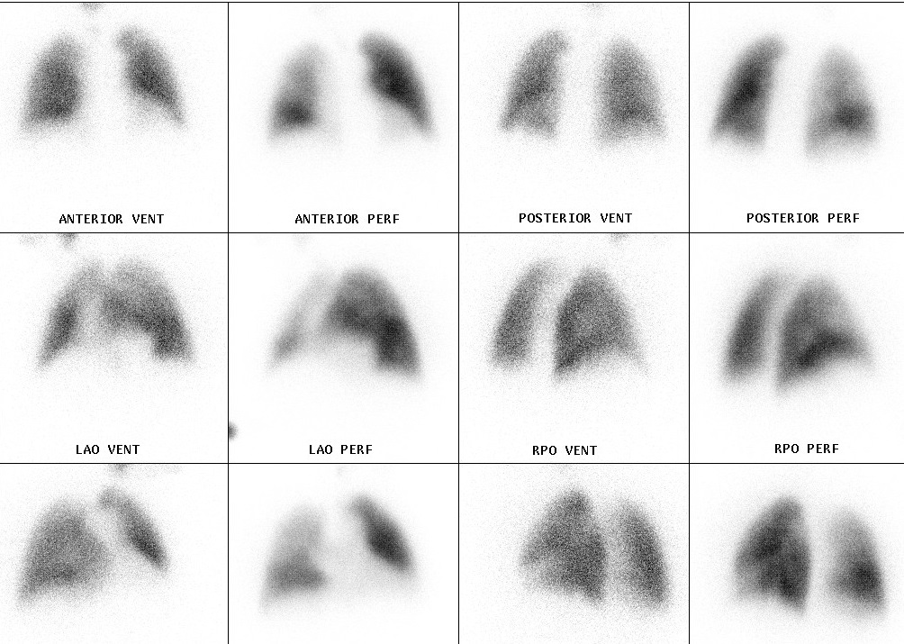 Lecture Notes in Medical Technology: Lecture #8: THE PULMONARY SYSTEM