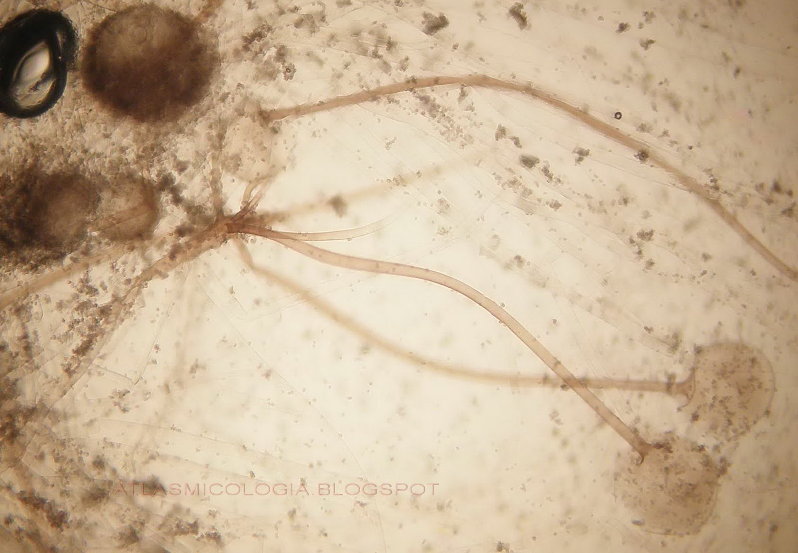 ATLAS MICOLOGIA: RHIZOPUS SP.