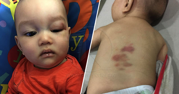 Lebam di mata dan badan, pengasuh kata bayi dibaling dengan 'toys ...