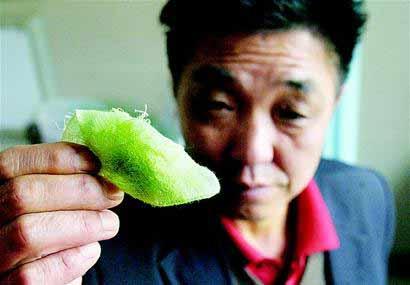 Strange Syndromes: Sweaty Conditions