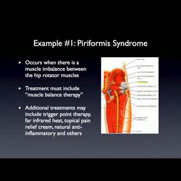 MAKLUMAT KESIHATAN DAN PENYAKIT: Sakit Saraf Sciatica 1 (urat di antara ...