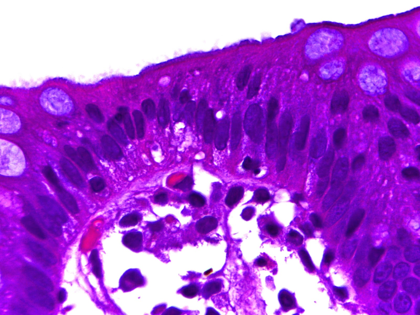 GASTROINTESTINAL AND LIVER HISTOLOGY PATHOLOGY ATLAS: COLON NORMAL