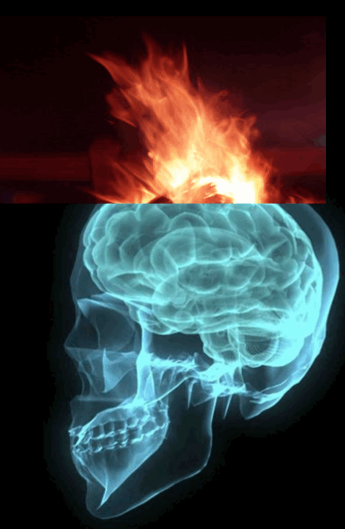Rapid Sequence Termination (RST) of status epilepticus