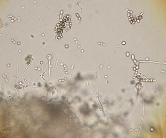 ATLAS MICOLOGIA: SCYTALIDIUM DIMIDIATUM (Neoscytalidium dimidiatum)