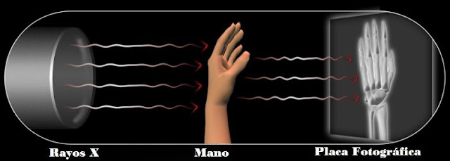 Funcionamiento del tubo de rayos X