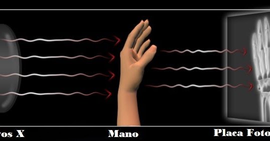 Funcionamiento del tubo de rayos X