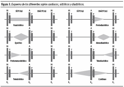 Corazón con Dr. Corcho: Soplos Cardiacos