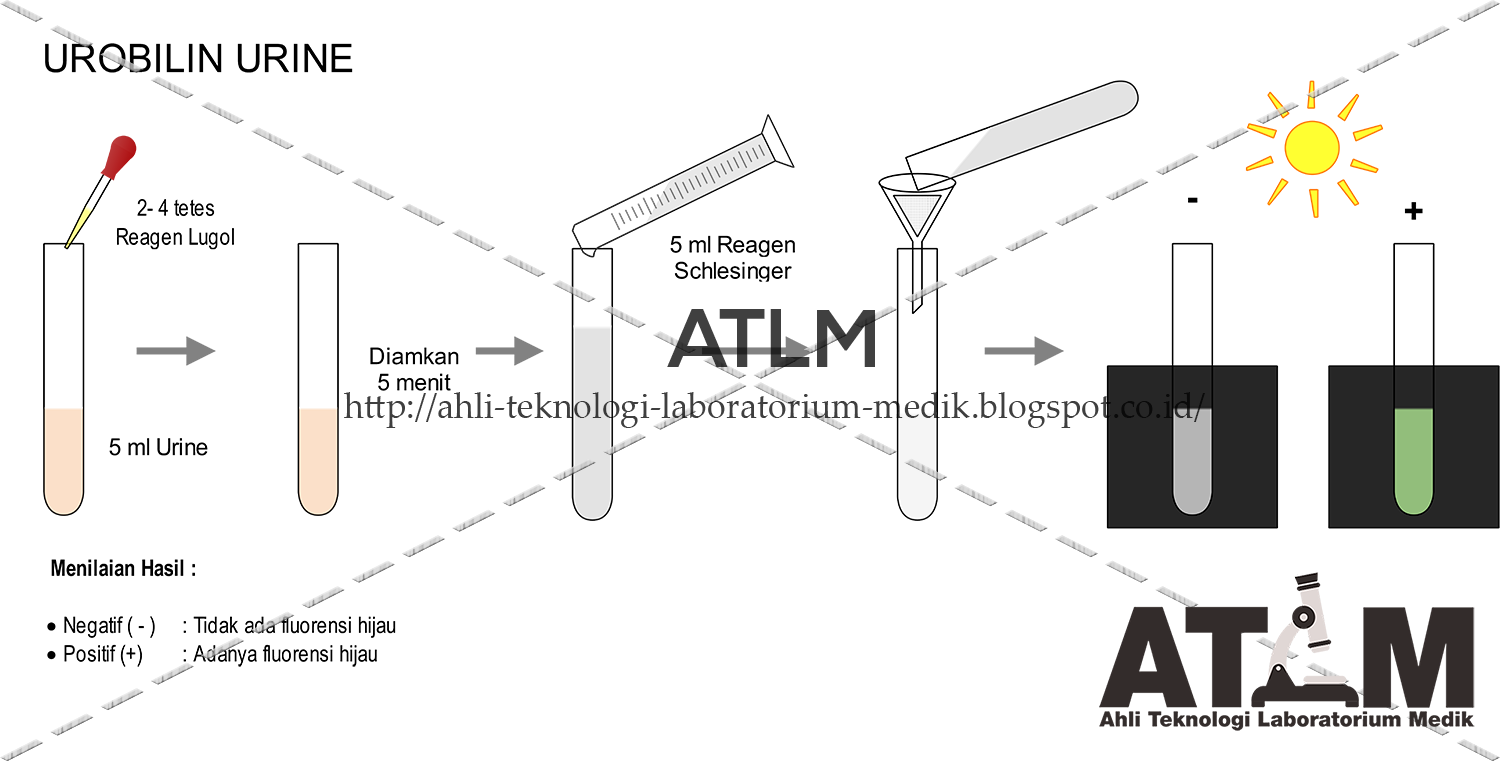 Pemeriksaan Urobilin Cara Schlesinger — Online Text Book ATLM