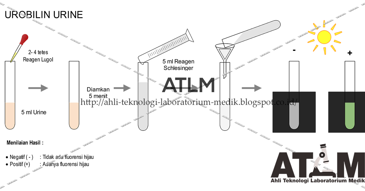 Pemeriksaan Urobilin Cara Schlesinger — Online Text Book ATLM